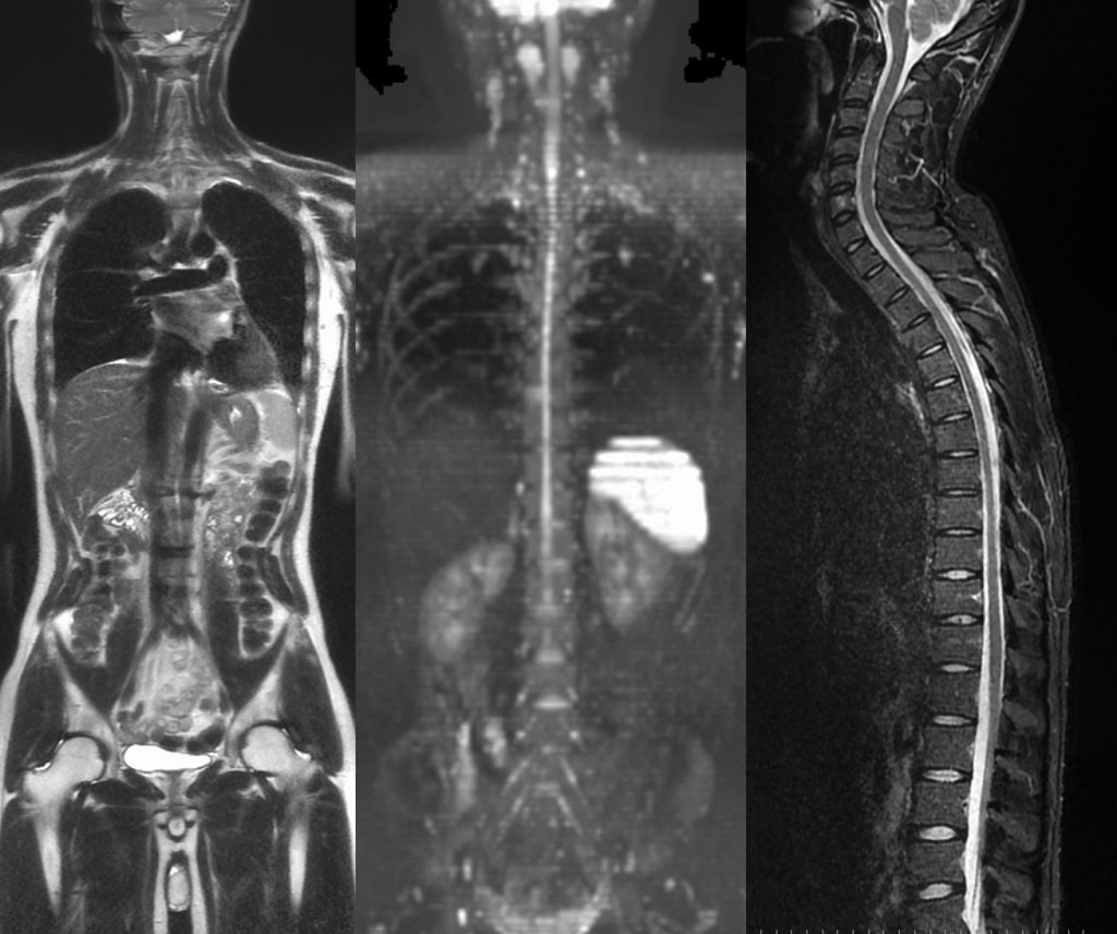 MRI全身がん検診（ドゥイブス検査）をはじめました！ - 都島放射線科クリニック｜高精度放射線治療・IVR融合型クリニック